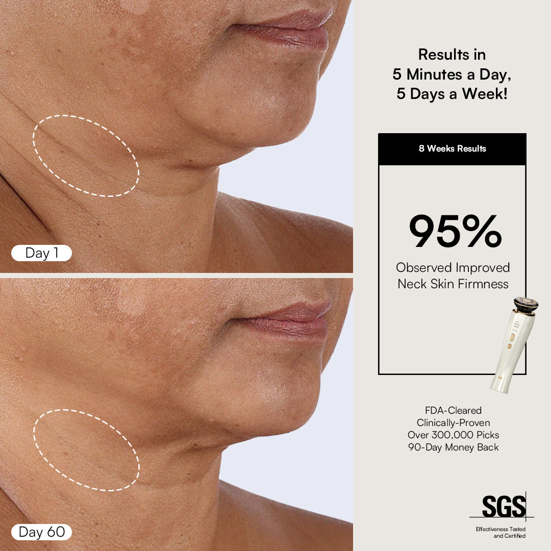 Microcurrent Facial Device | Non-Surgical Skin Tightening | INIA