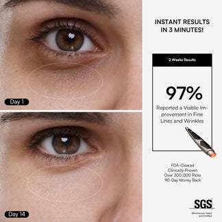 INIA LUMIN Eye Skincare – 4-in-1 Device for Radiant Eyes