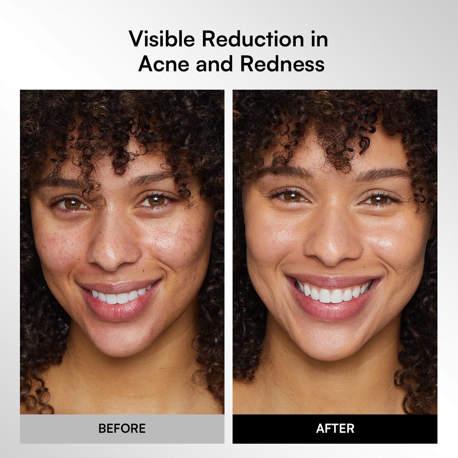 Red Light Therapy Mask | Anti-Aging Face Treatment | INIA